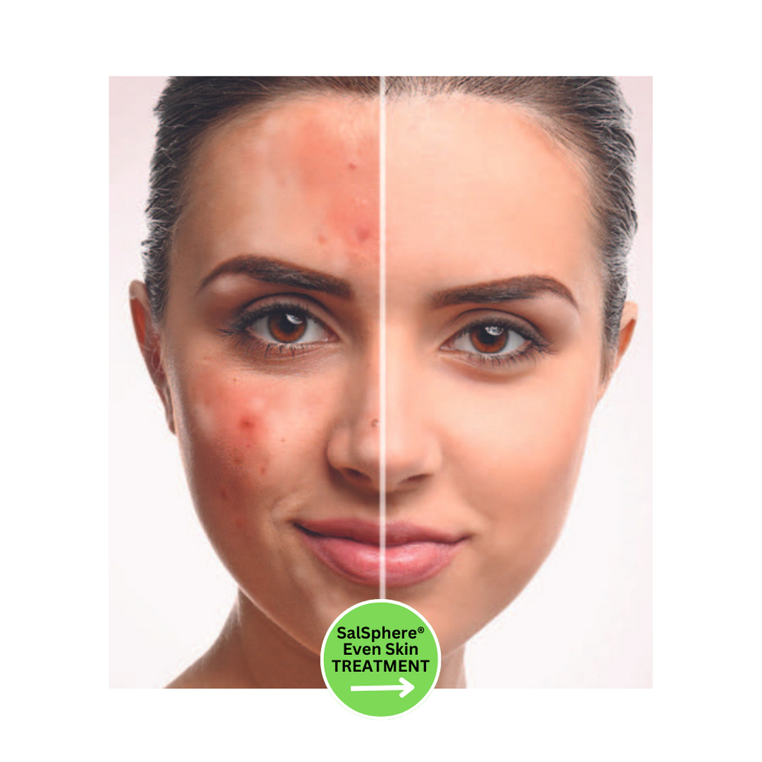 Products — Salvona Technologies